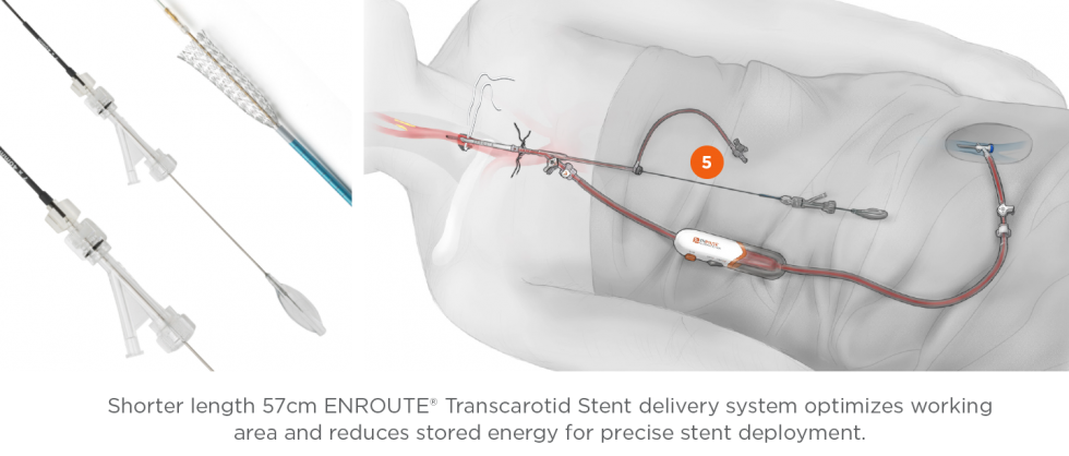 ENROUTE® Transcarotid Neuroprotection System | Silk Road Medical